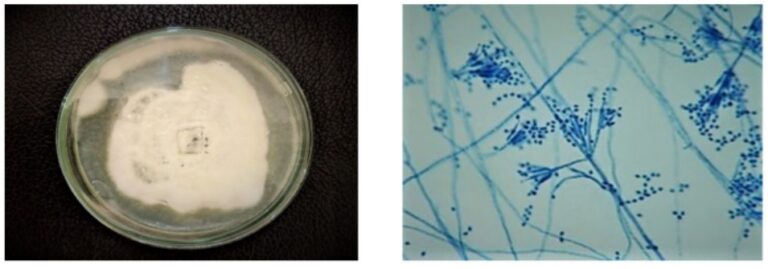 Controle biológico de nematoides: 5 microrganismos utilizados